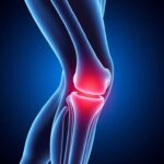 A Comprehensive Guide to ICD-10 codes for right knee pain - wmwtl