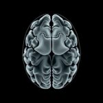 A Comprehensive Guide to ICD-10 dementia unspecified - wmwtl