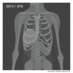 A comprehensive guide to ICD-10 code Z11.3 - wmwtl
