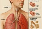 The Complete Guide to ICD-9 Codes for COPD: Understanding 491, 492, and ...