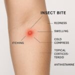 Understanding the ICD-9 Code for Insect Bite: A Complete Historical and ...