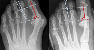 CPT Code for Abdominal Aortogram: A Complete Coding Guide - wmwtl