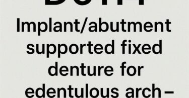 Decoding the Dental Code for Fixed Lingual Retainer - wmwtl