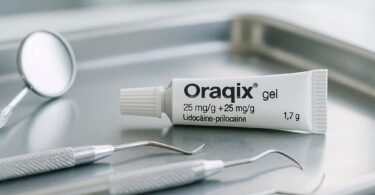 The Ultimate Guide to the Dental Code for Overdenture - wmwtl