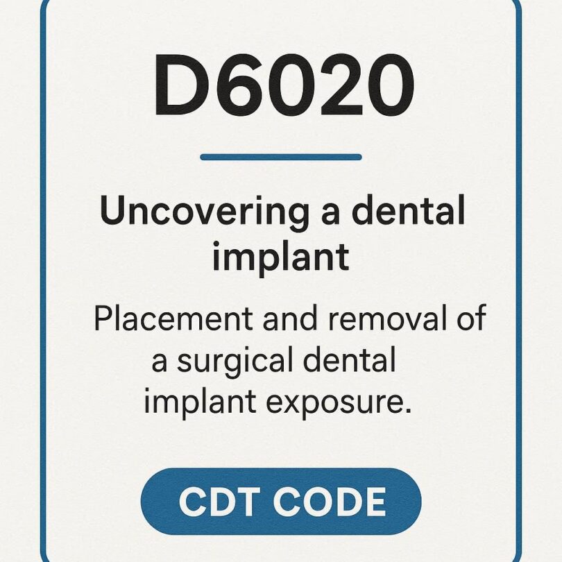 CDT Code for Uncovering a Dental Implant (2026 Update) - wmwtl