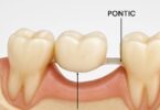 Understanding Dental Code D9999: Unspecified Adjunctive Procedure, by ...